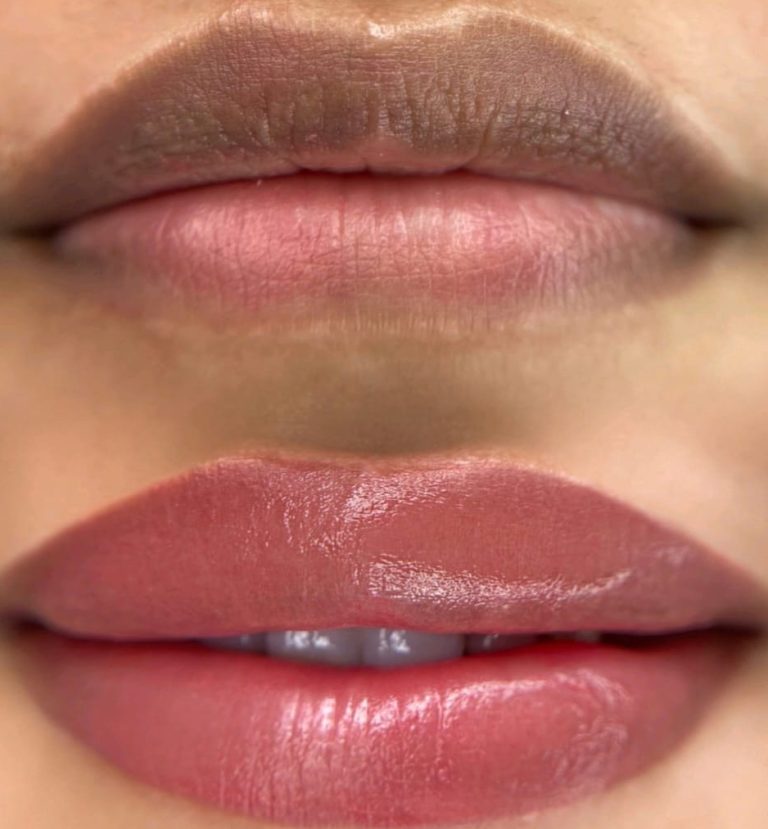 Dark Lip Neutralization vs Lip Blush Tattoo: What to Choose